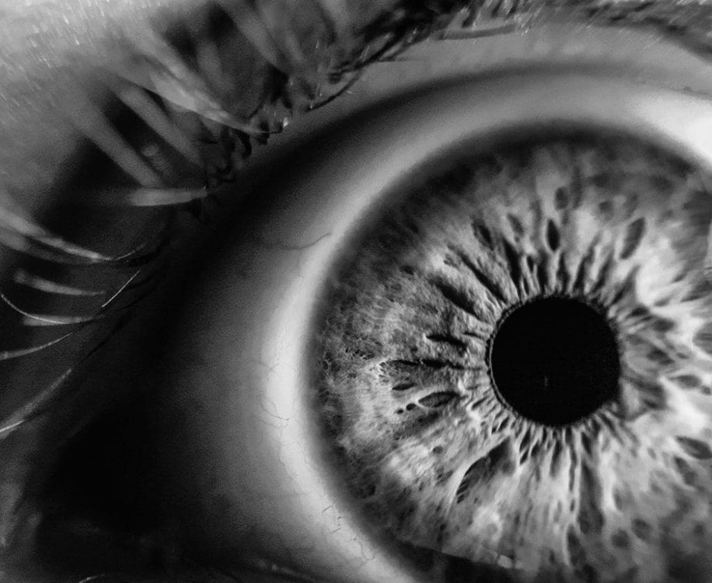 DSAEK (Corneal Endothelial Transplant) | LaserVision Surey