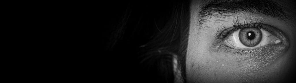 Meibomian Gland Dysfunction Surgery | Dry Eye | MGD