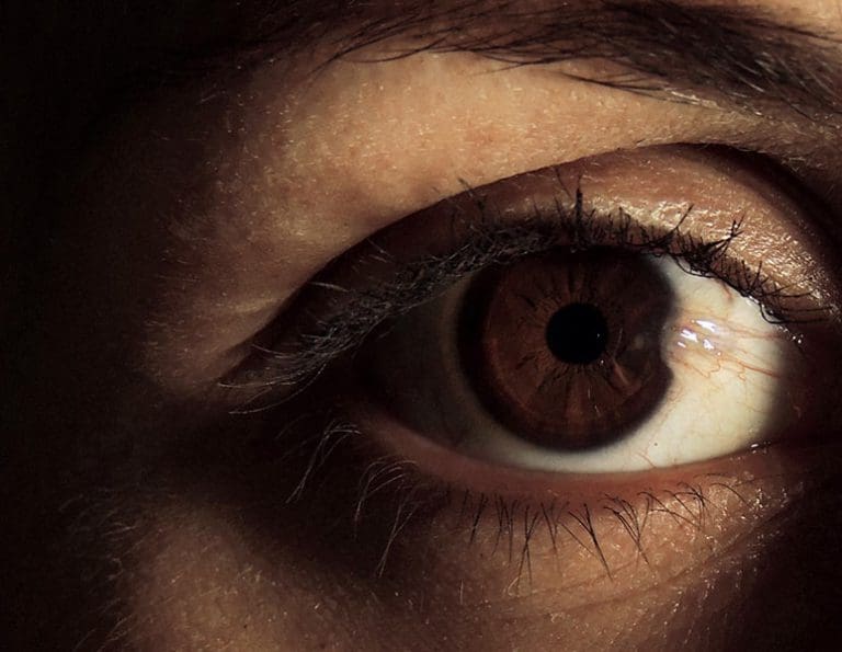 Pterygium Surgery | LaserVision