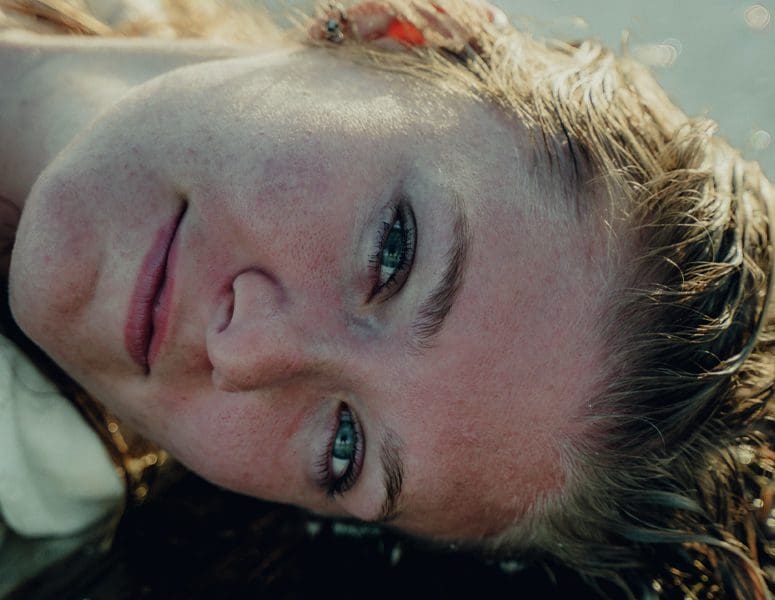 Inward Turning Eyelid (Entropion) | LaserVision | Oculoplastics