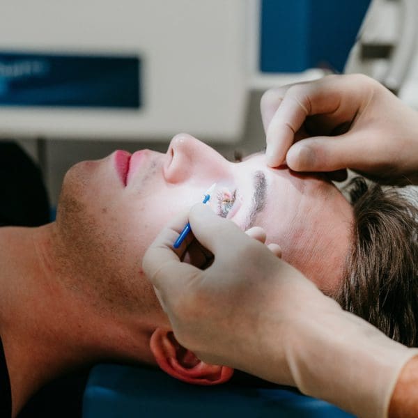 BlephEx | LaserVision