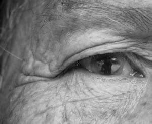 Macula Hole / VMT Surgery