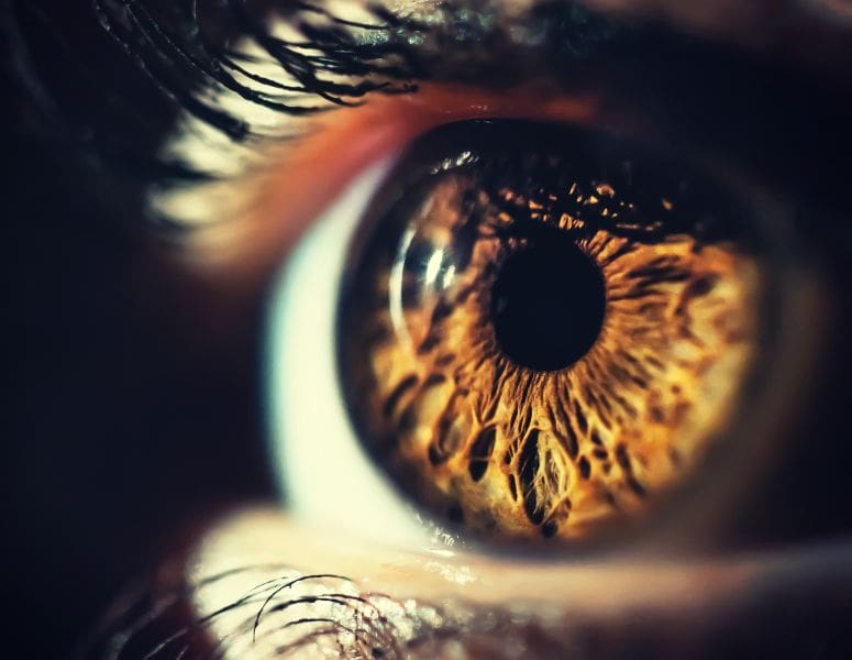 YAG Iridotomy and SLT | LaserVision